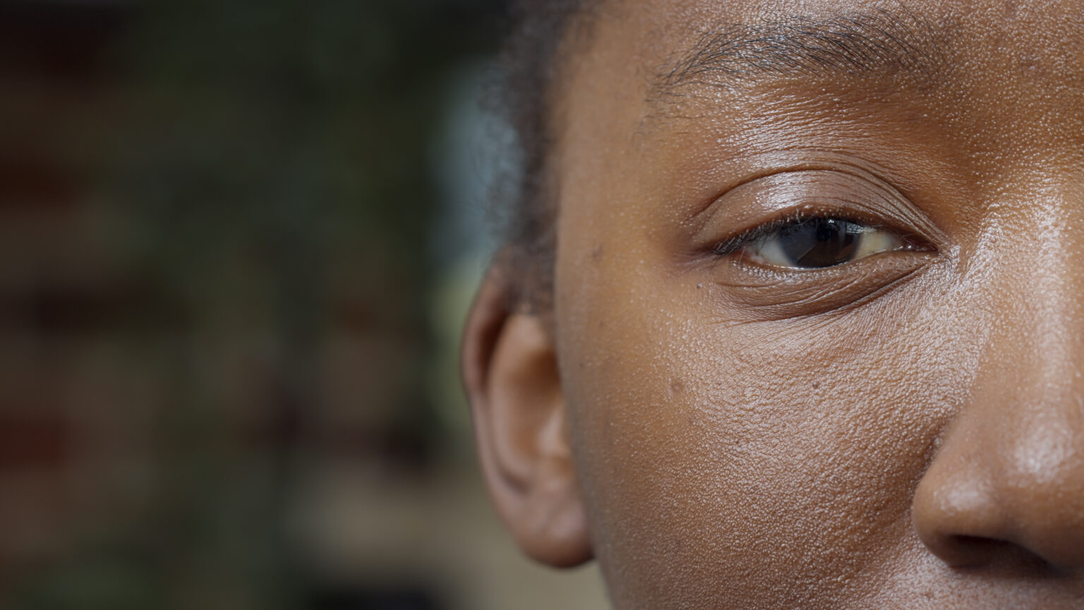 Journal – Blind People Organisation Uganda | Retina Blind Vision