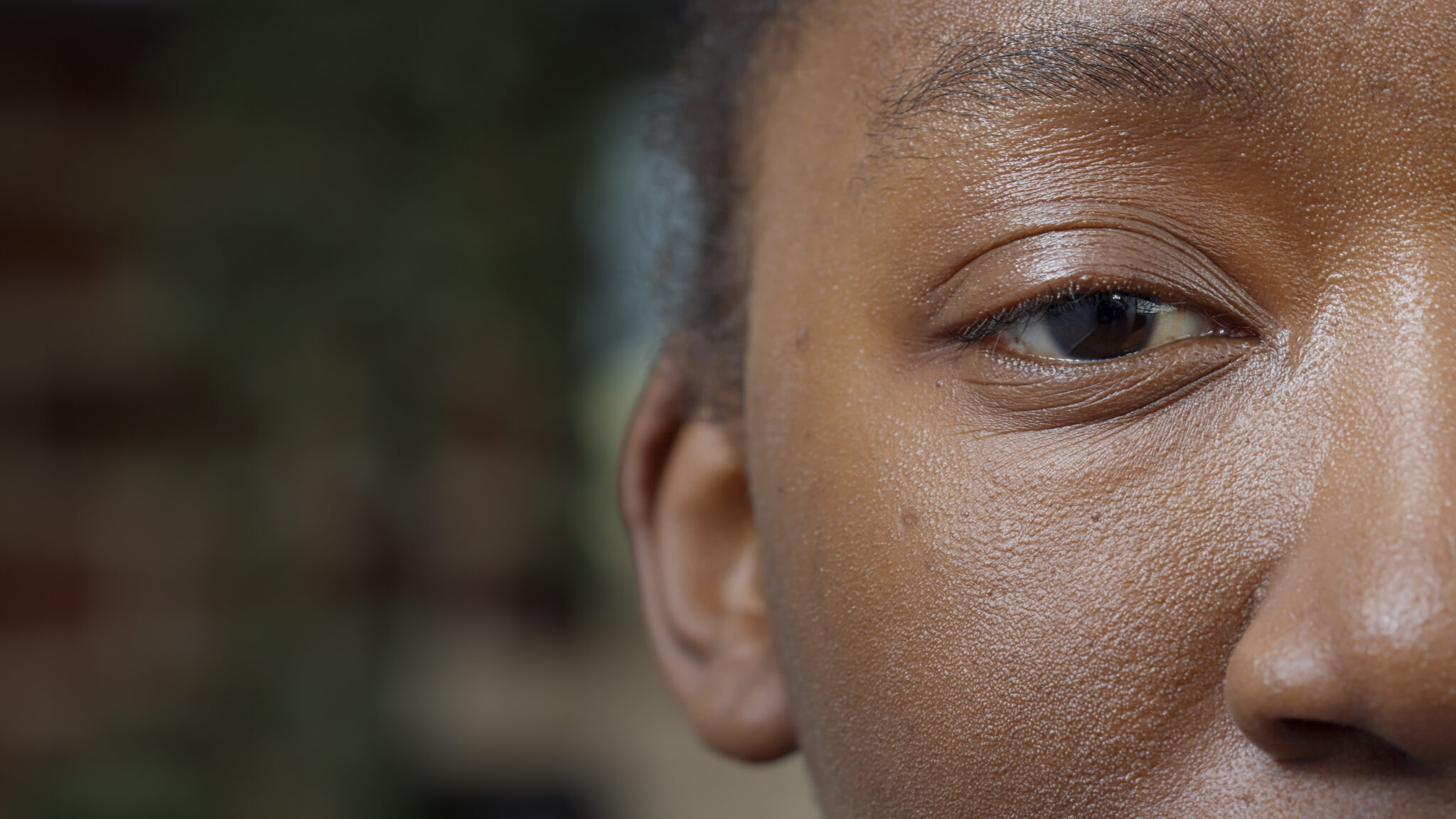 Journal – Blind People Organisation Uganda | Retina Blind Vision